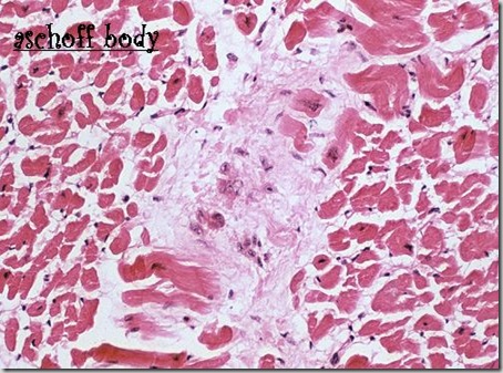 Medicine Decoded: Medical pearls{high yield facts}